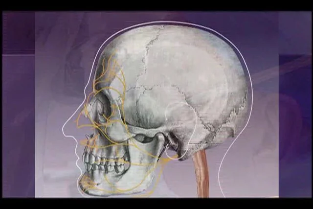 The Jannetta Procedure