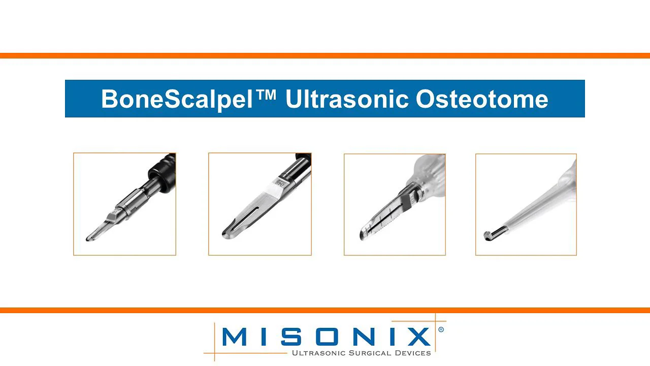 Tissue Selectivity of BoneScalpel Ultrasonic Osteotome on Vimeo
