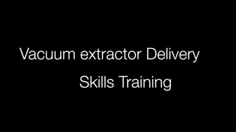Vacuum Delivery Video