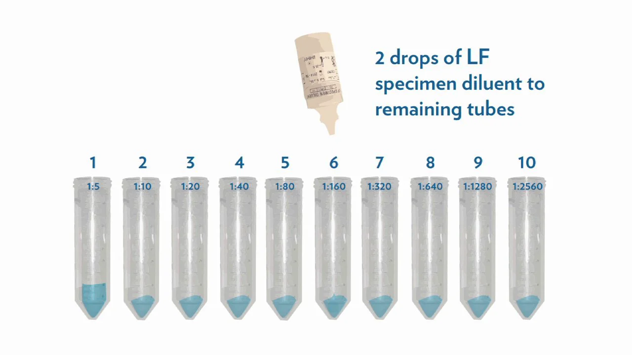 IMMY's Cryptococcal Antigen Lateral Flow Assay Training - Part 2 of 2