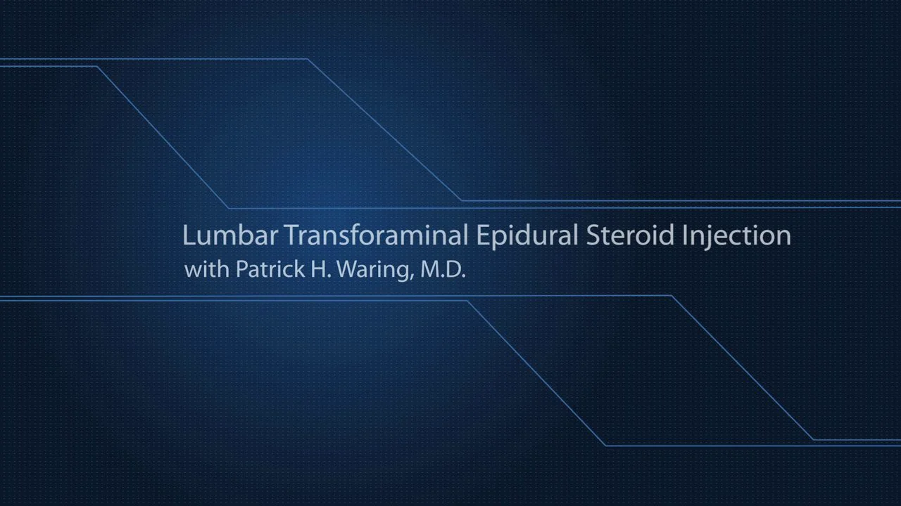 Lumbar Transforaminal Epidural Steriod Injection on Vimeo