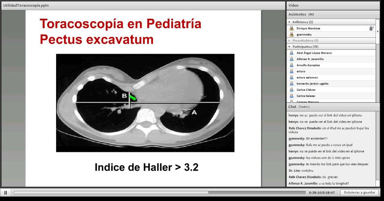 Utilidad de la Toracoscopía en Pediatría 0 0 on Vimeo