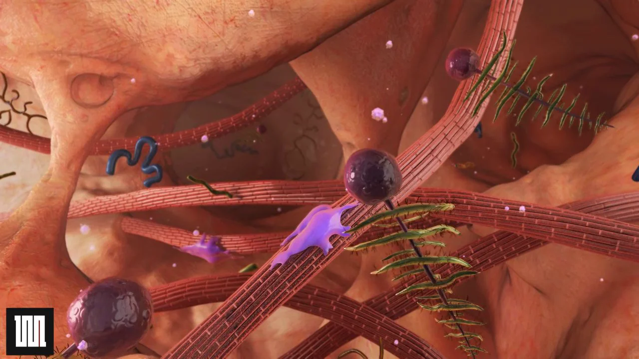 3D Medical Animation