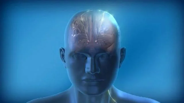 Deep Brain Stimulation therapy - Animation