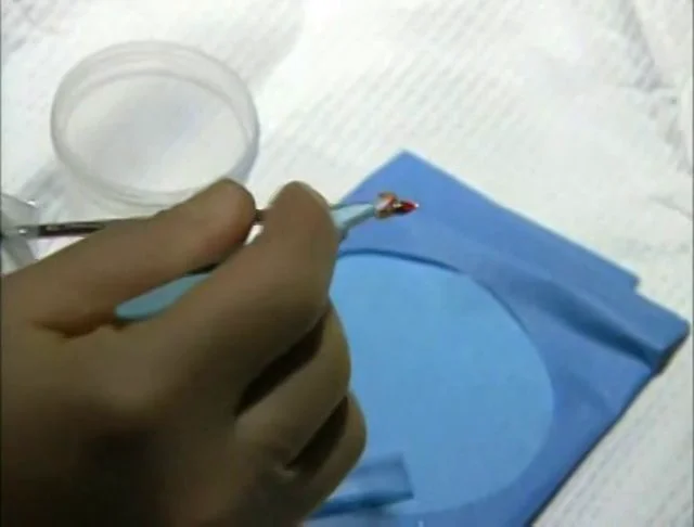 Vacora® Biopsy System Procedural Videos Bard Biopsy on Vimeo