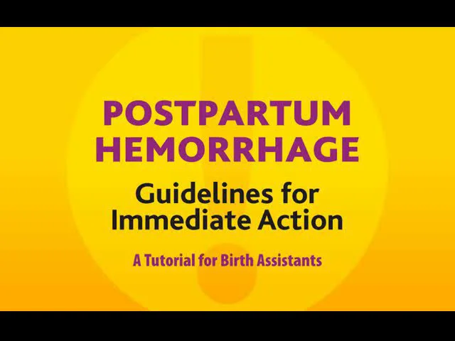 postpartum hemorrhage guidelines 1