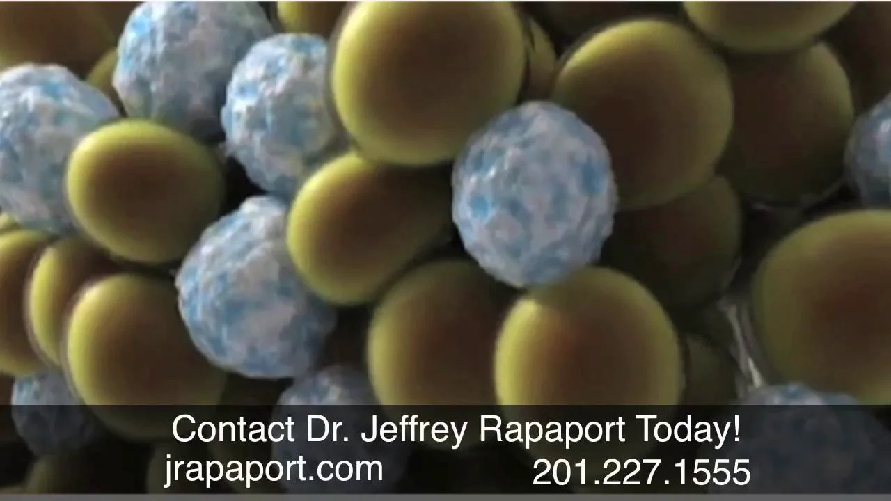 New Jersey Coolsculpting, Dr. Jeffrey Rapaport on Vimeo
