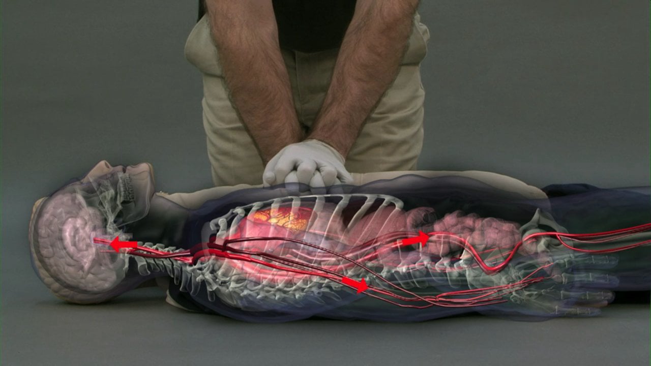 3D Animation - Chest compression animations Client: Dr Stanley Malamed ...