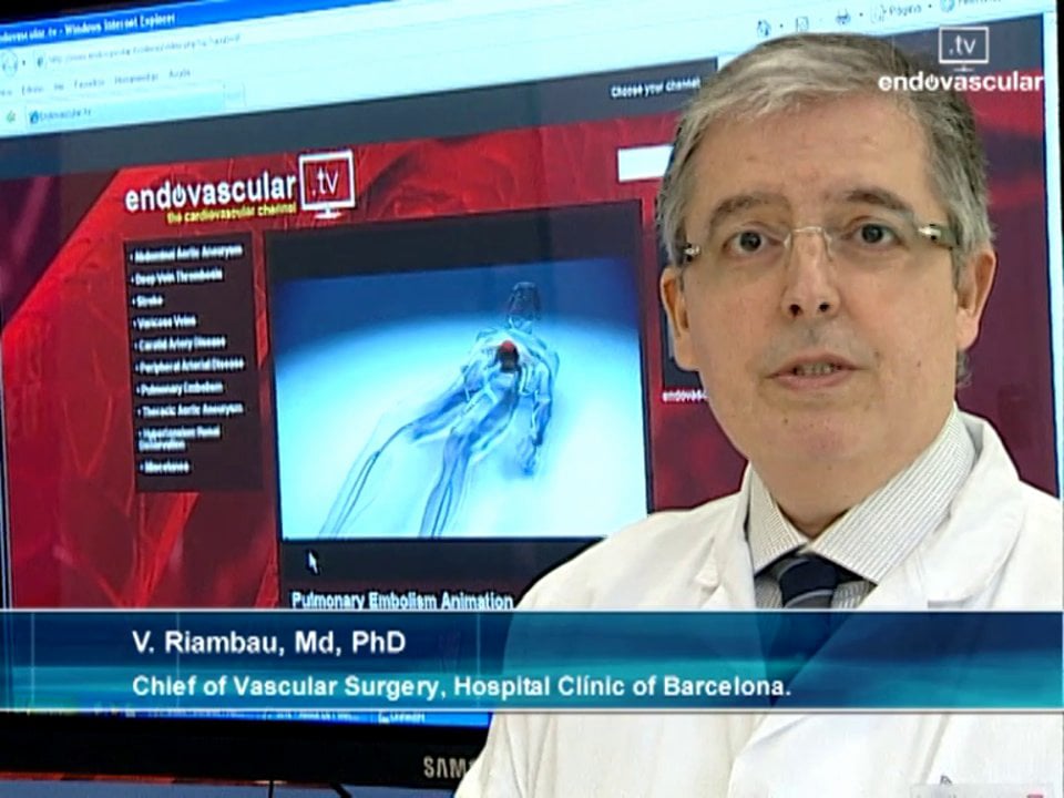 DR. RIAMBAU welcomes you to endovascular.tv on Vimeo
