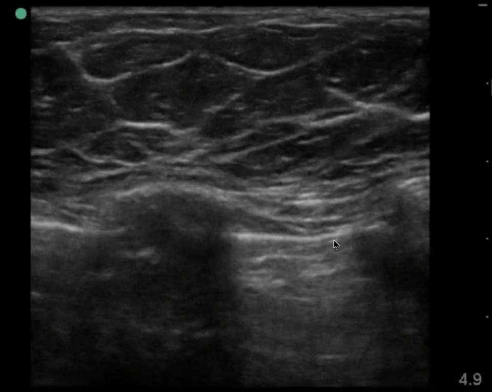 double lung point on Vimeo