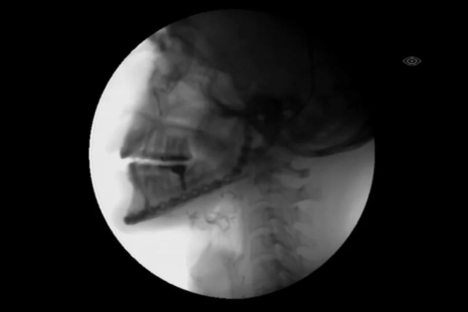 Ed Steger MBS (07-11 -2012)