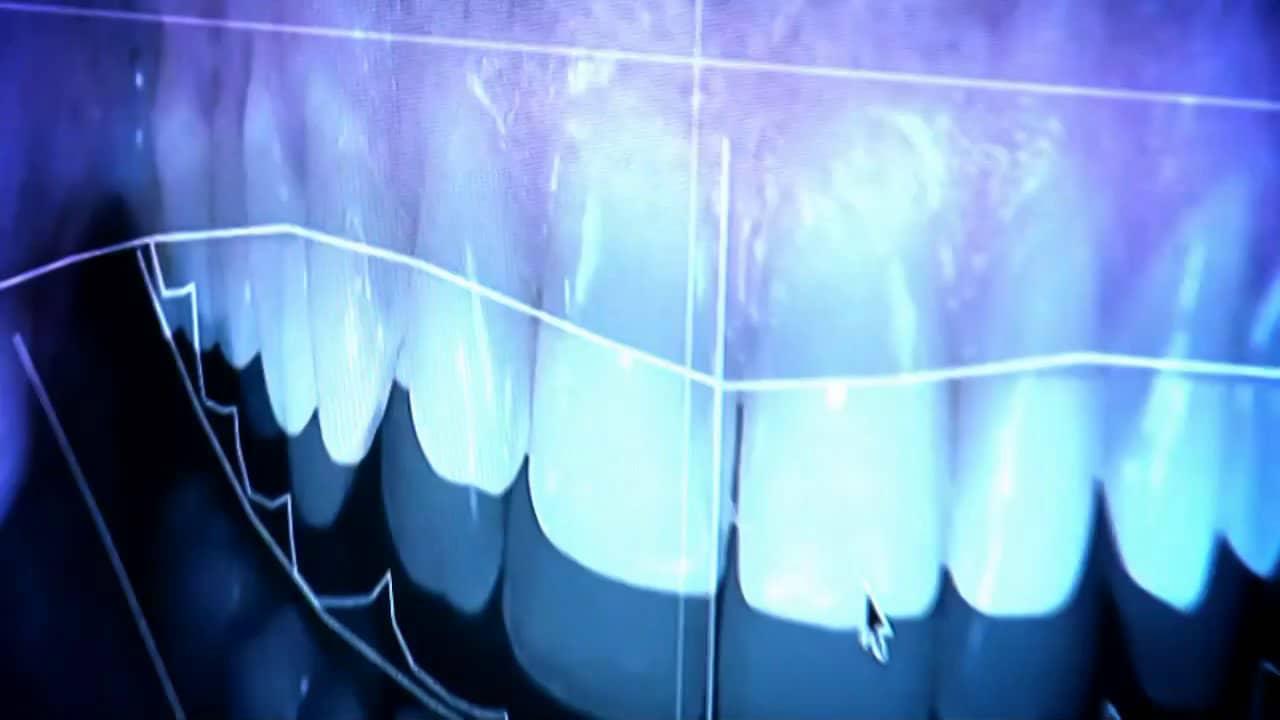 Christian Coachman - Digital Smile Design on Vimeo