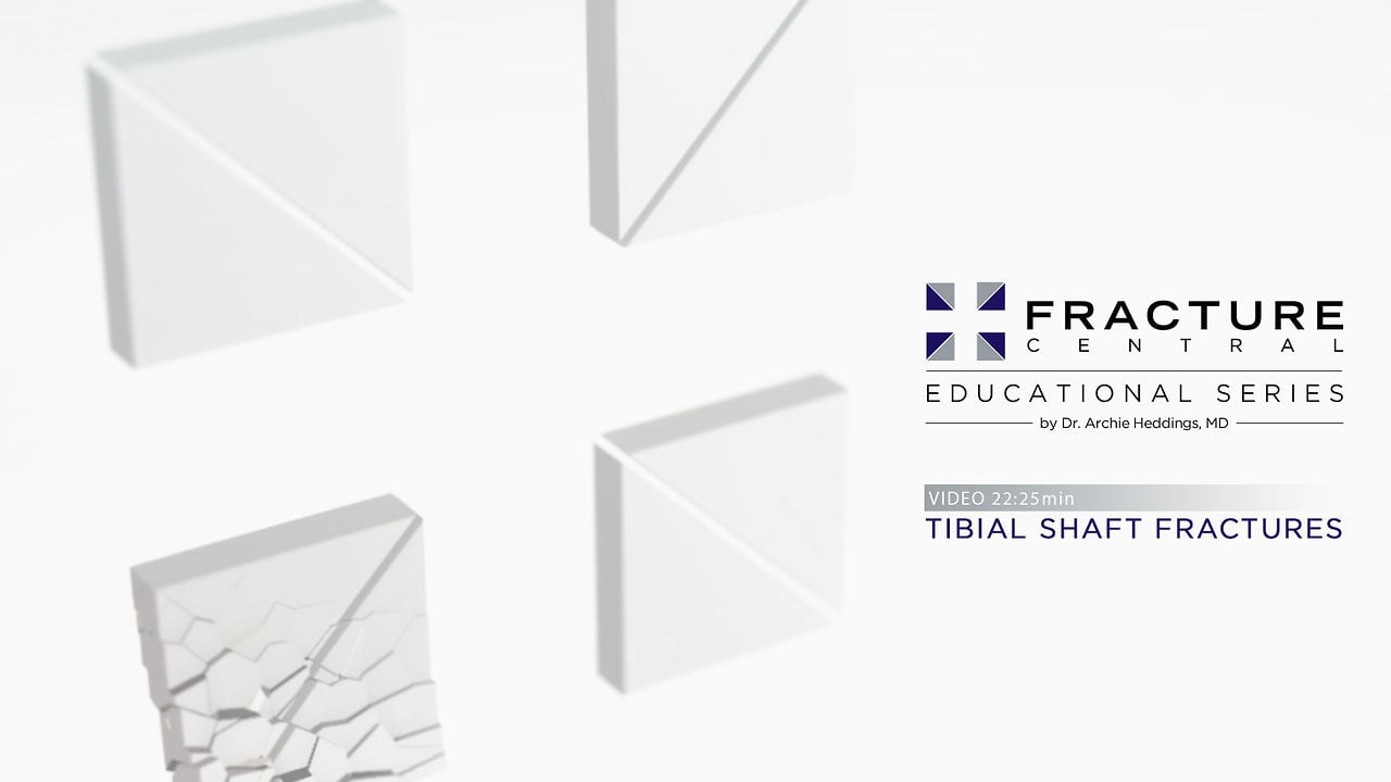 Fracture Central Education / Inspiration - Tibial Shaft Fractures ...