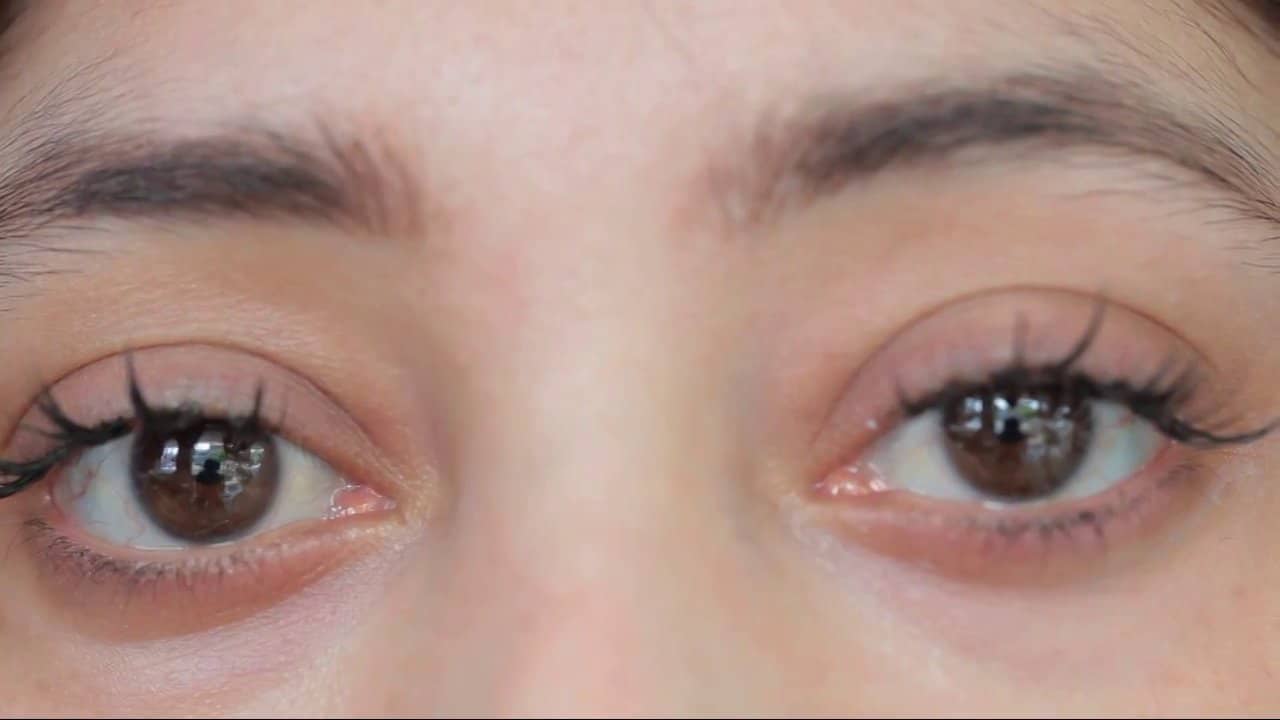 Permanent eye color change surgery 2013 Brightocular on Vimeo