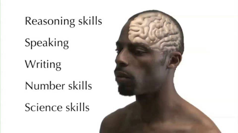 Lesson 2 - Brain Anatomy on Vimeo