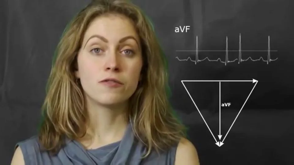 How to measure the augmented limb leads aVF, aVR and aVL of the ECG on ...