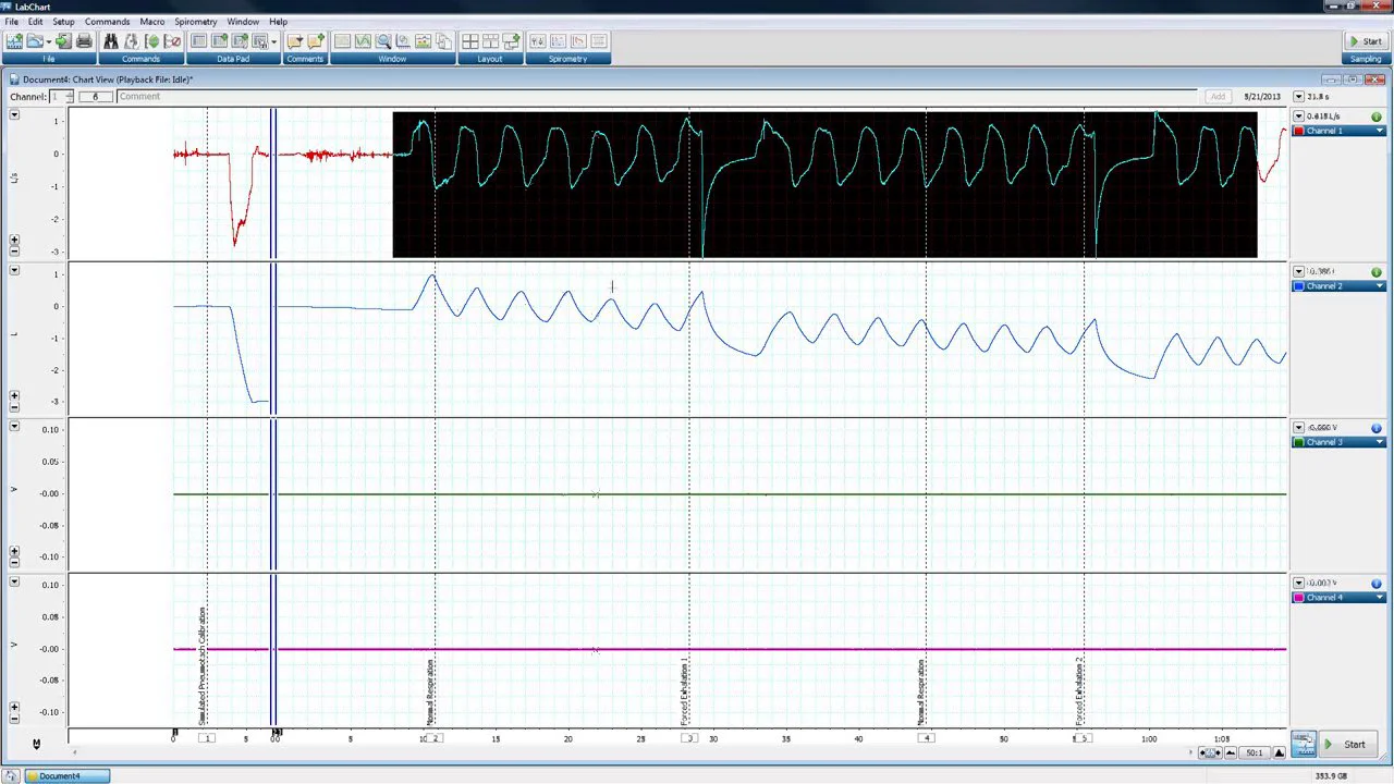 LabChart Mastery - Calibrating your Respiratory Flow and using the Spirometry Extension