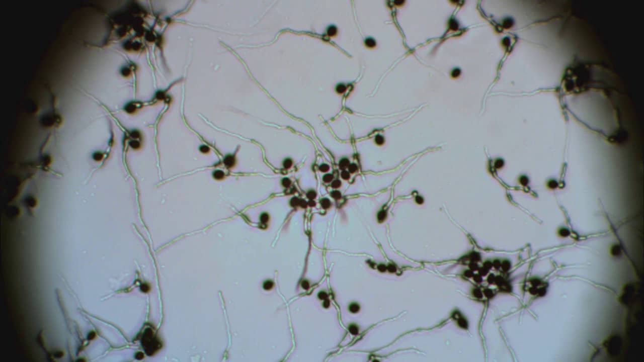 Observation de spores de Sordaria après germination on Vimeo