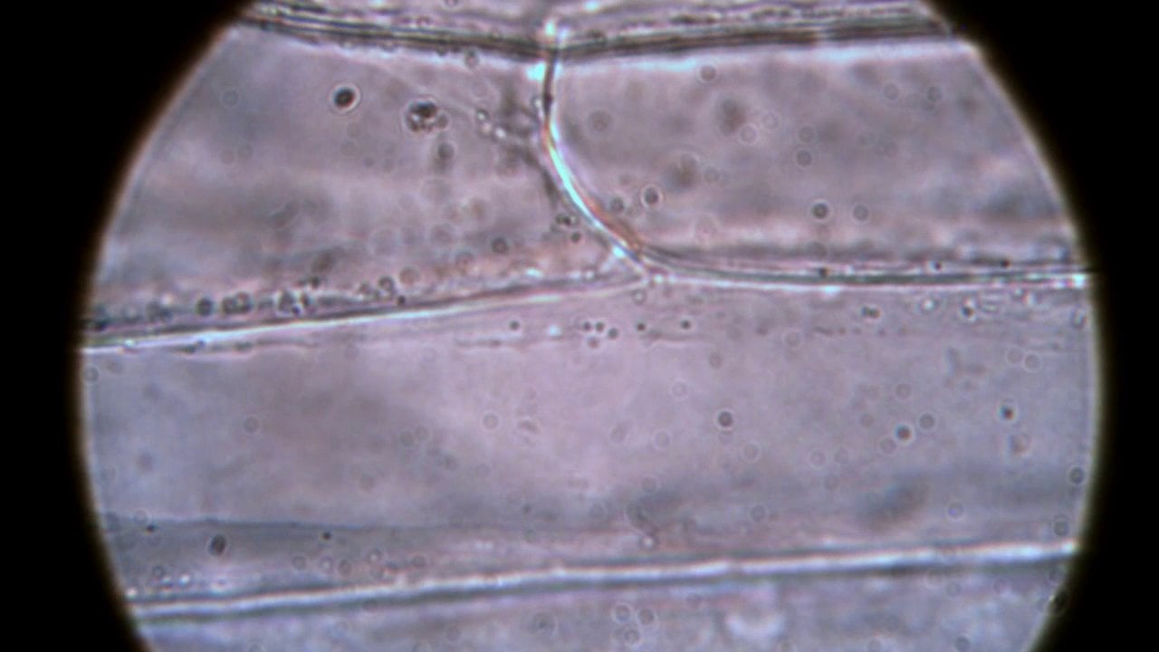 Observation de la cyclose sur de jeunes cellules d'épiderme d'oignon on ...