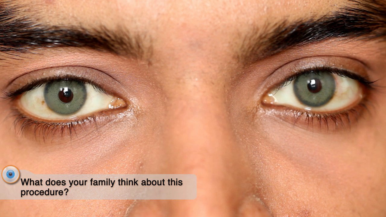 Permanent eye color change surgery from brown to olive green eyes ...