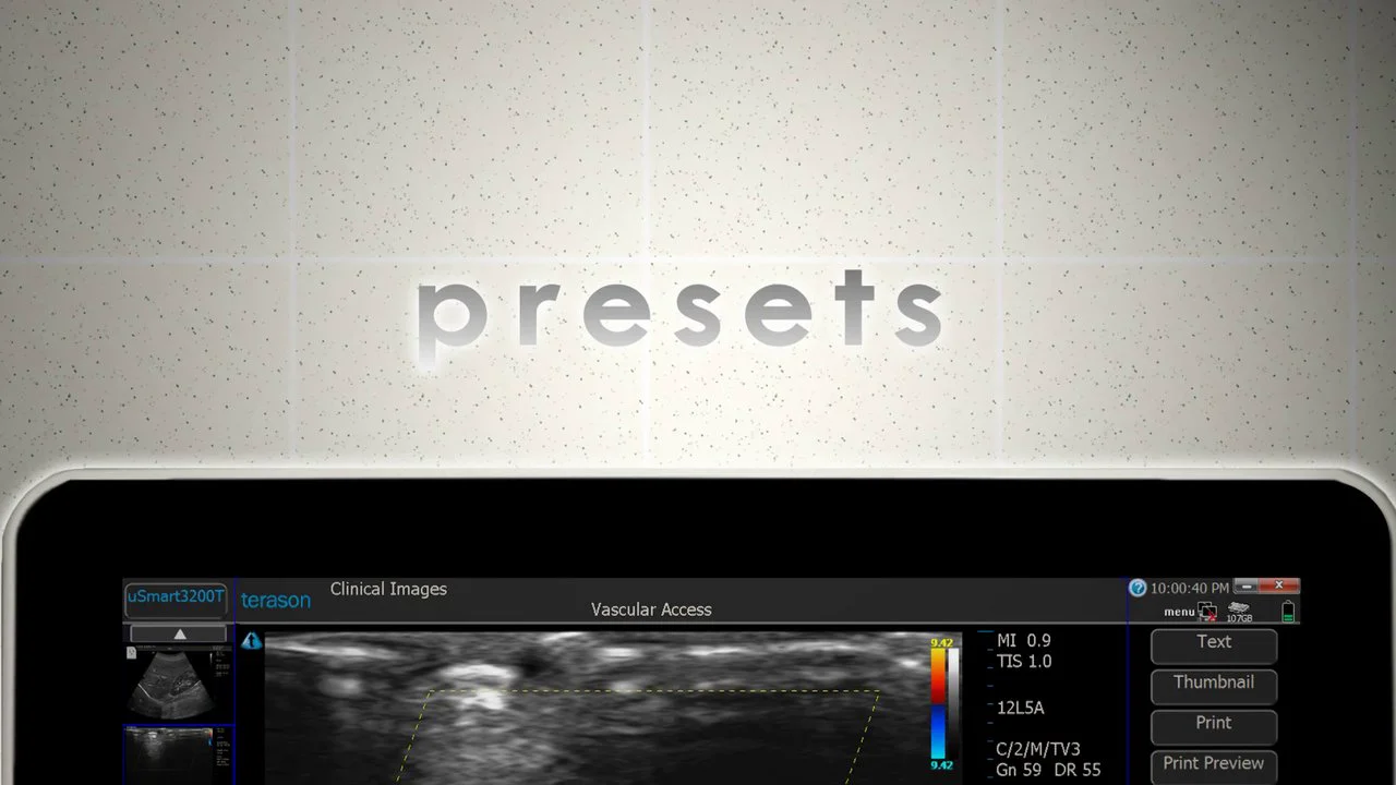 Terason Ultrasound Video - Introducing the Terason uSmart 3200T on Vimeo