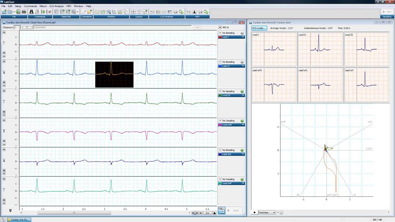 Labchart Mastery Cardiovascular Software Analysis Primer Using The Ecg Analysis Hrv And 
