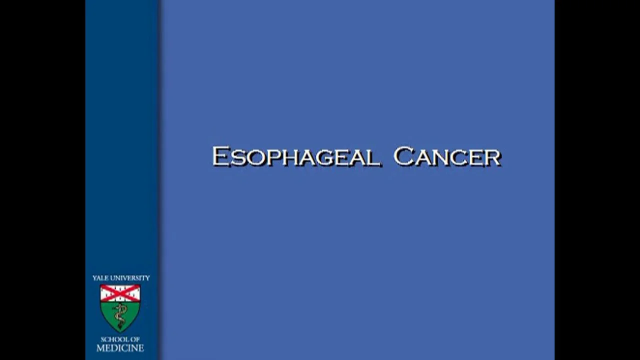 DIDACTIC LECTURES - Dr. Daniel Boffa - ESOPHAGEAL CANCER - 33 min ...