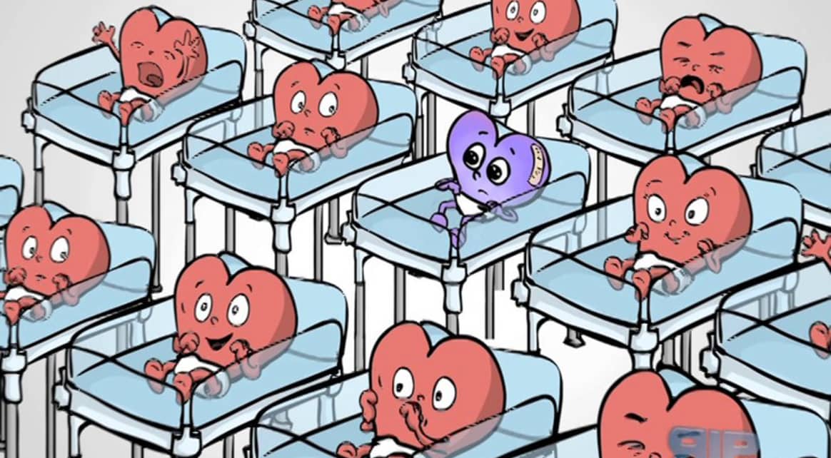 Baby Hearts: Congenital Heart Defect Explained. Whiteboard Animation by ...