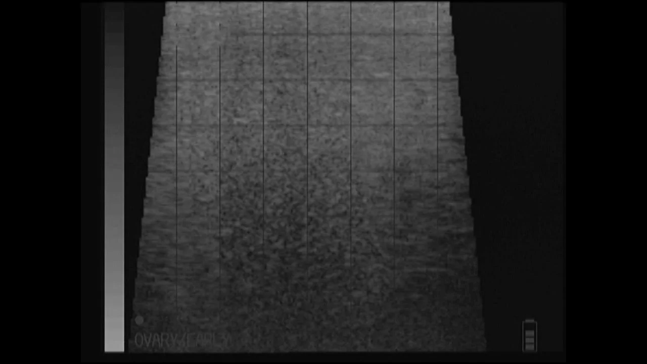 Udder normal bovine BCF Easi-Scan Curve on Vimeo