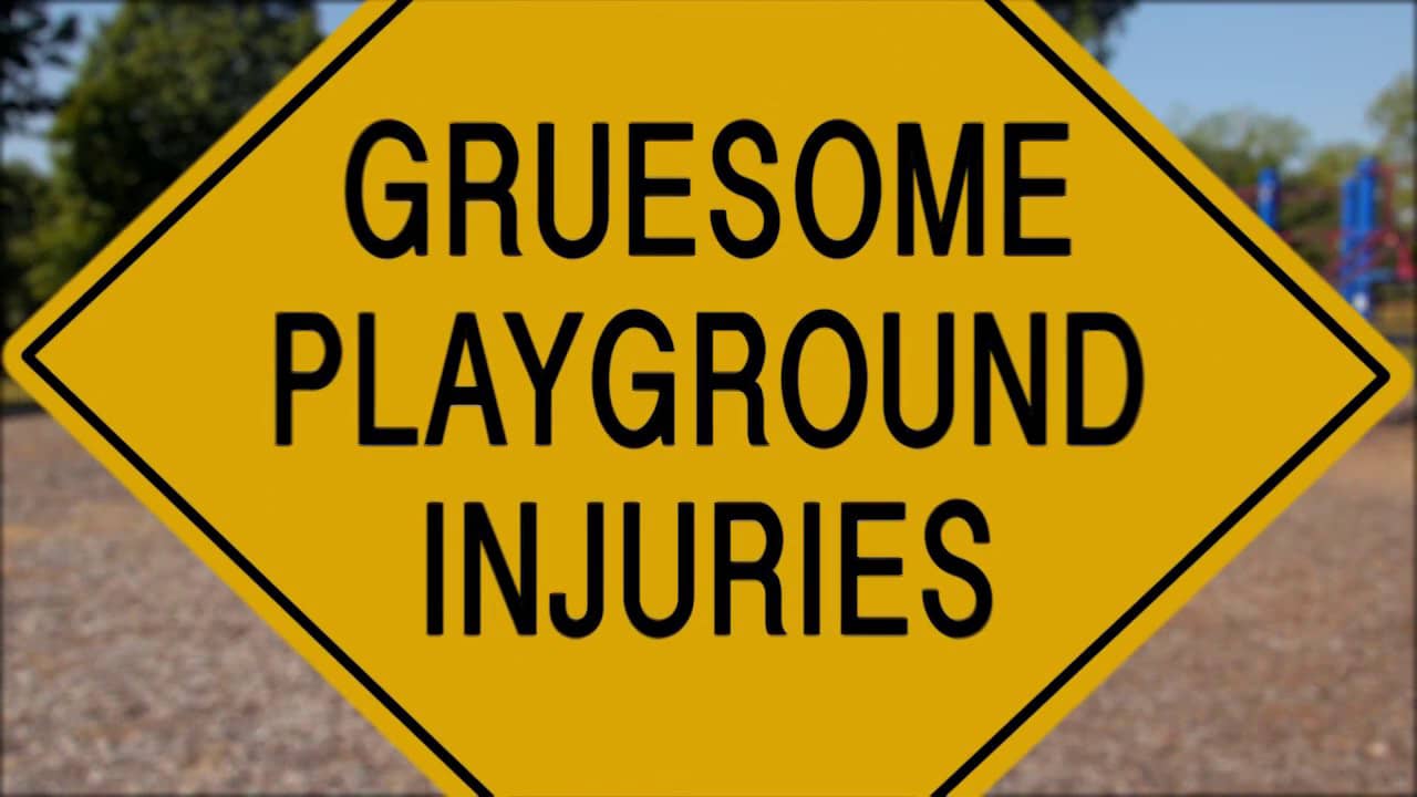 Gruesome Playground Injuries on Vimeo