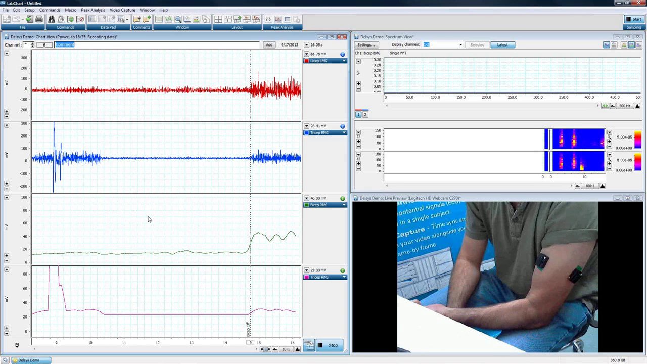 LabChart Mastery - Using the Delsys Trigno Wireless EMG System on Vimeo