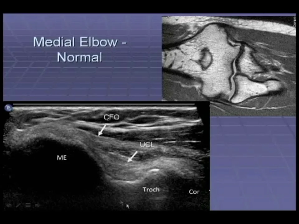 Department of Radiology - Conference Videos - Elbow Ultrasound on Vimeo