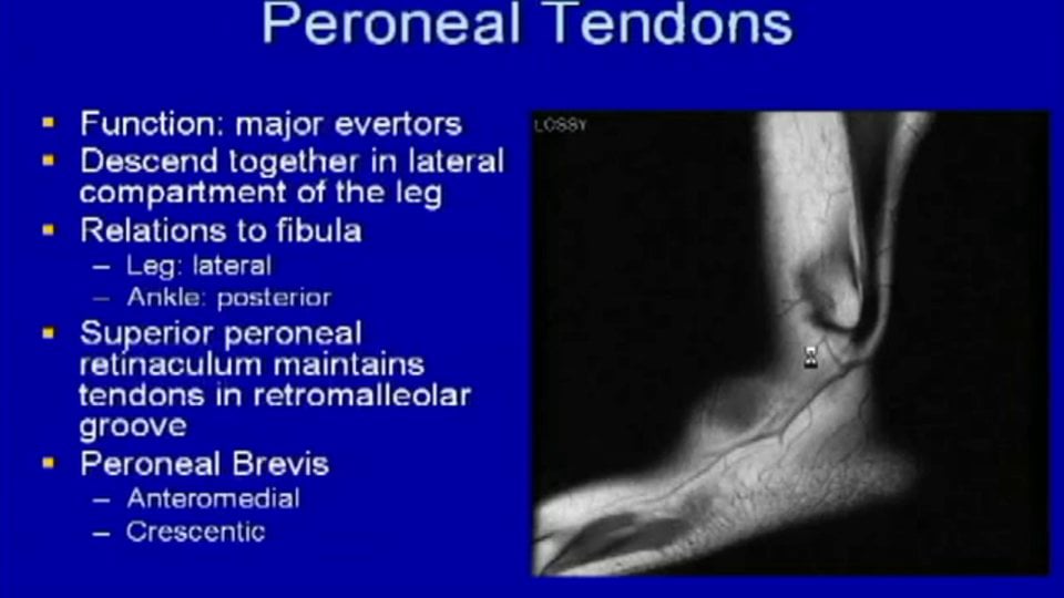 Department of Radiology - Conference Videos - Ankle Tendon Anatomy on Vimeo