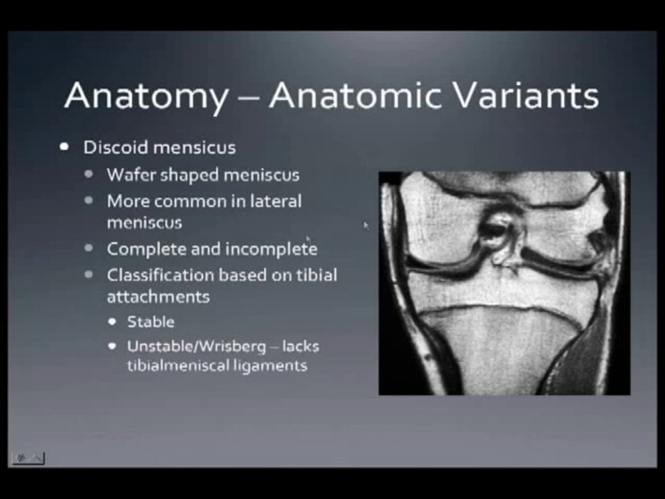 Department of Radiology - Conference Videos - Knee Menisci - Timothy ...