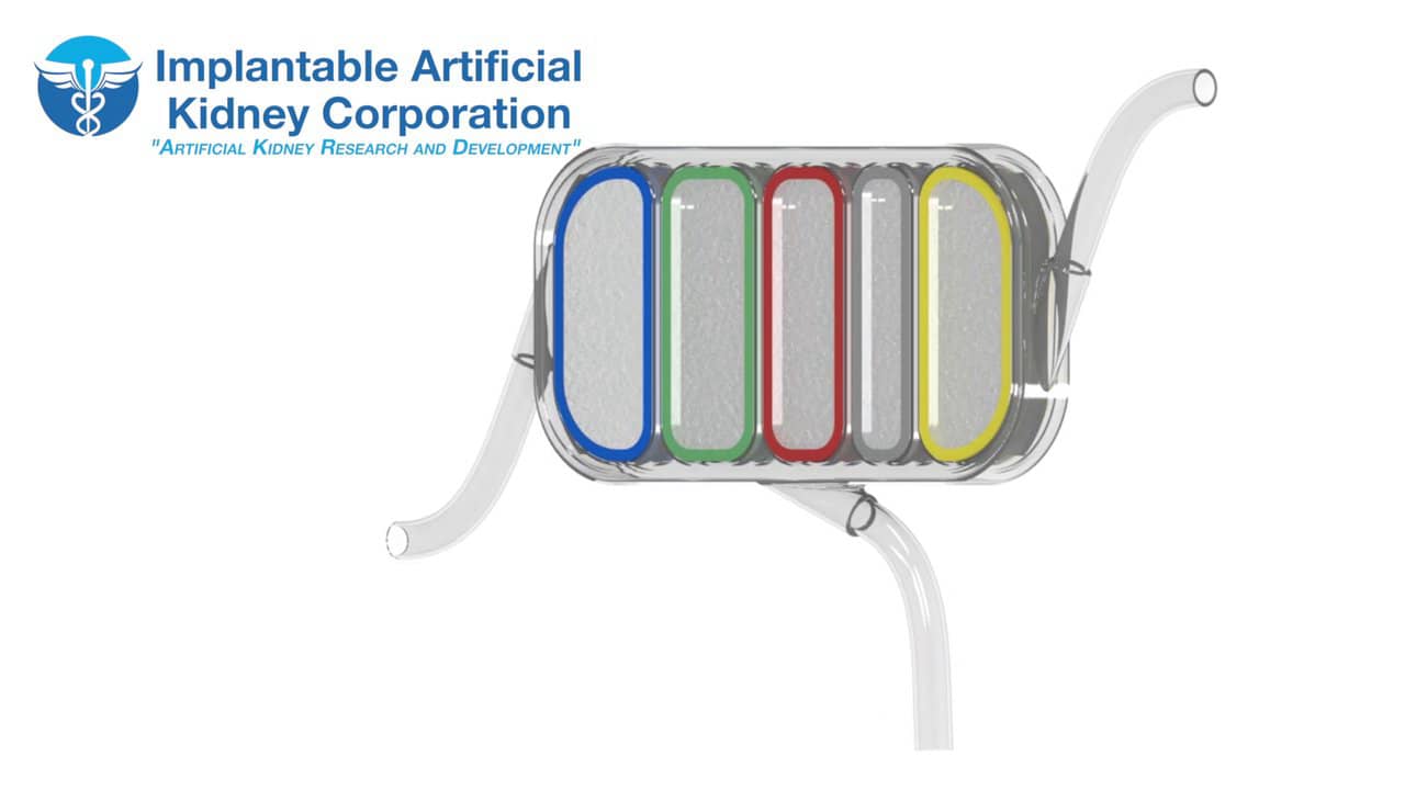 New Implantable Artificial Kidney Prototype on Vimeo