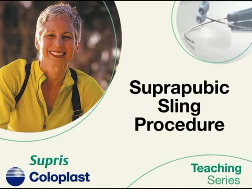 Coloplast Supris Sling Procedure on Vimeo