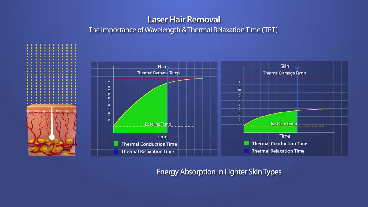 Thermal Relaxation Time on Vimeo