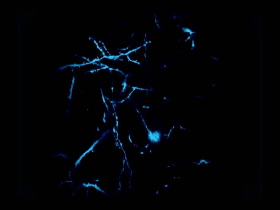 Live Neuron Imaging on Vimeo