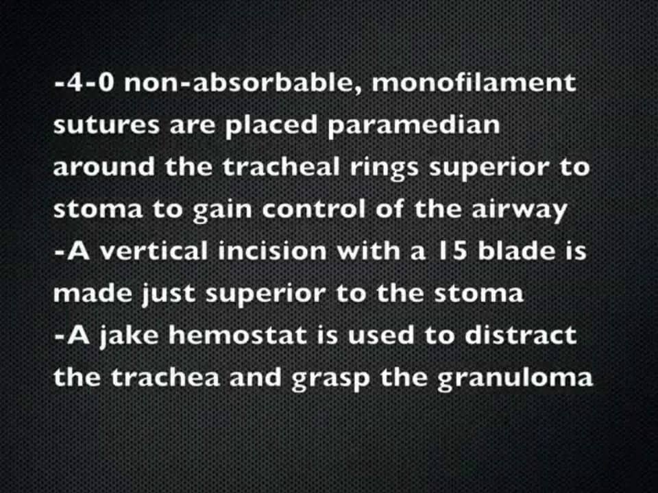 Surgical Video Suprastomal Granuloma on Vimeo