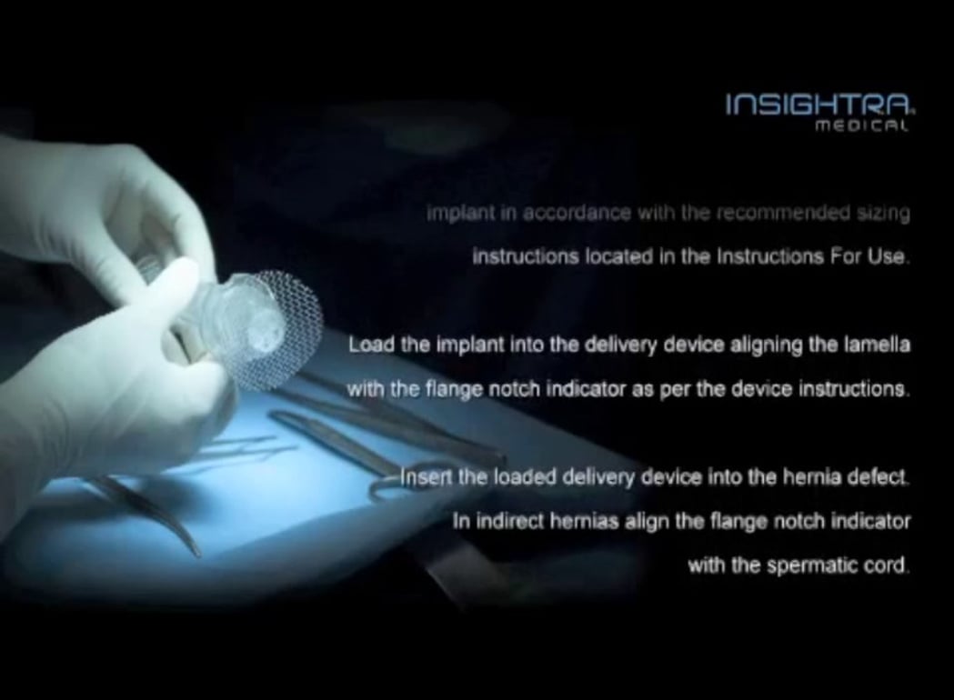 Insightra - Freedom - Inguinal - Hernia Repair System on Vimeo
