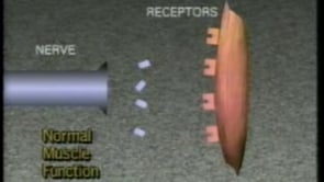 Myasthenia gravis | MedLink Neurology