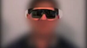 Blepharospasm | MedLink Neurology