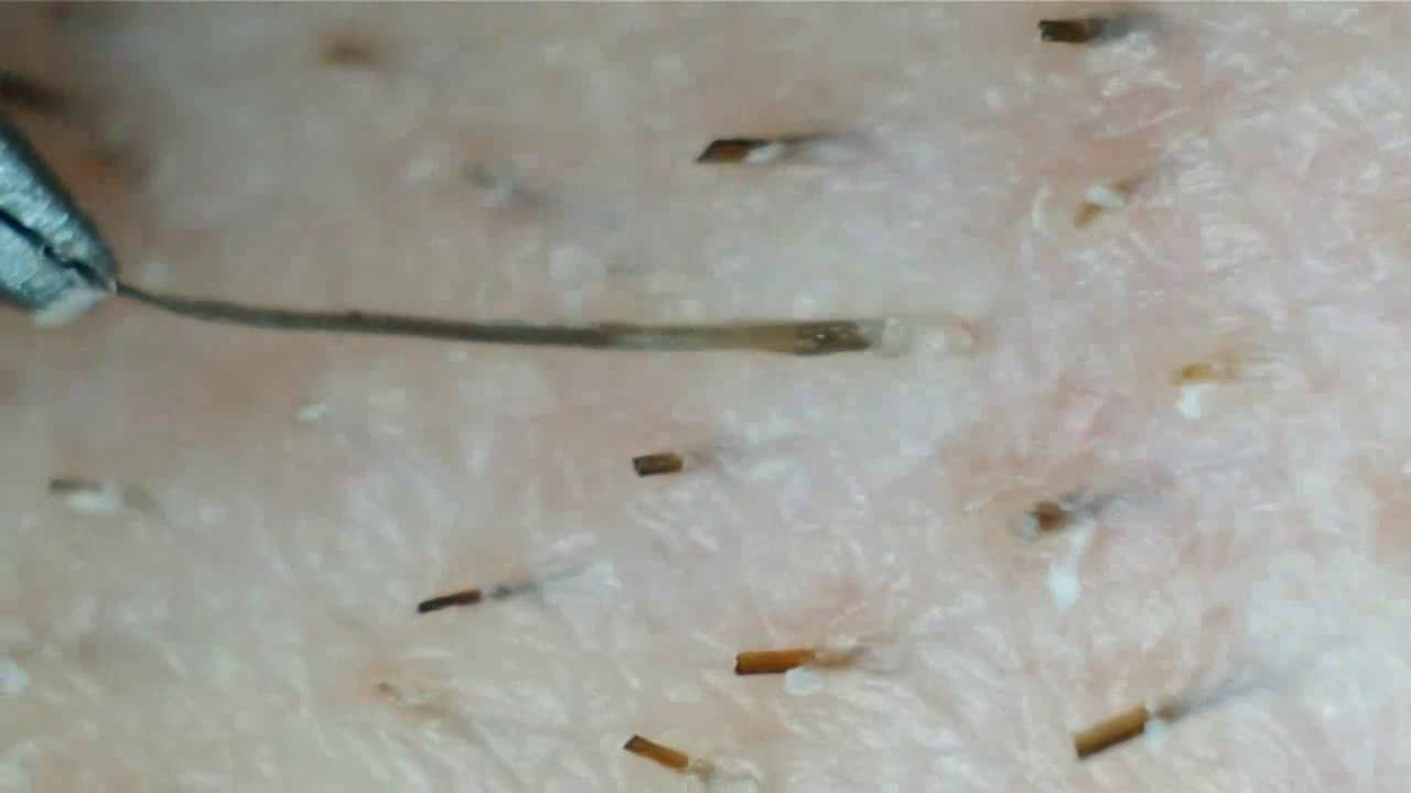 Pili Multigemini - Thick hair pulled on Vimeo