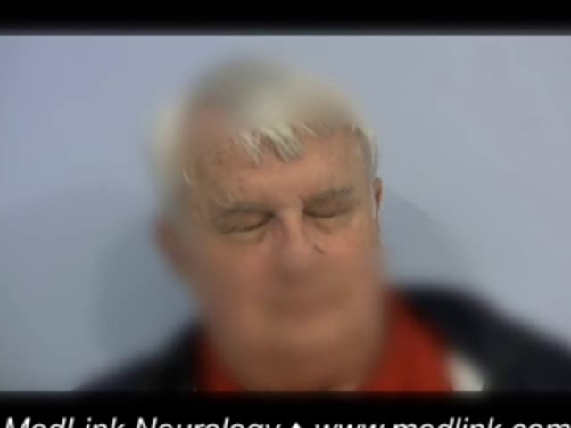 Neuro-ophthalmology of movement disorders | MedLink Neurology