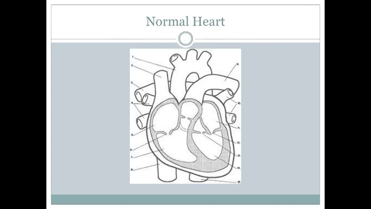 CHD 101 A Congenital Heart Defect Primer on Vimeo