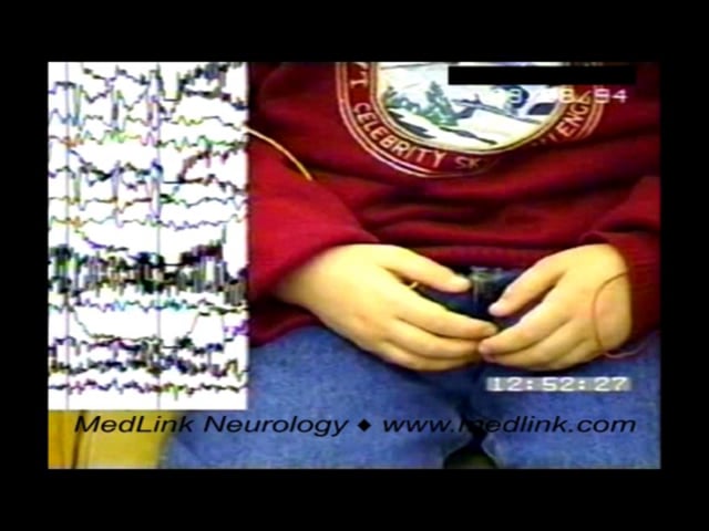 Reflex seizures | MedLink Neurology