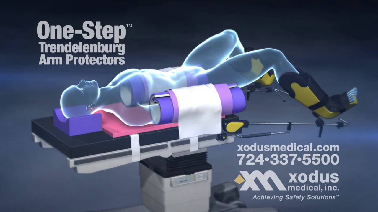 One-Step™ Trendelenburg Arm Protectors - Instructions for Use on Vimeo