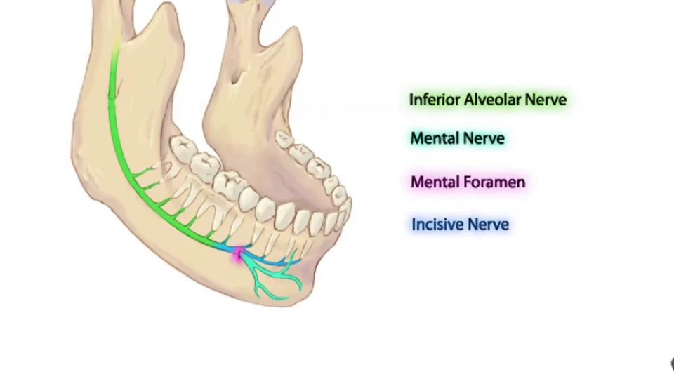 Incisive Nerve Block