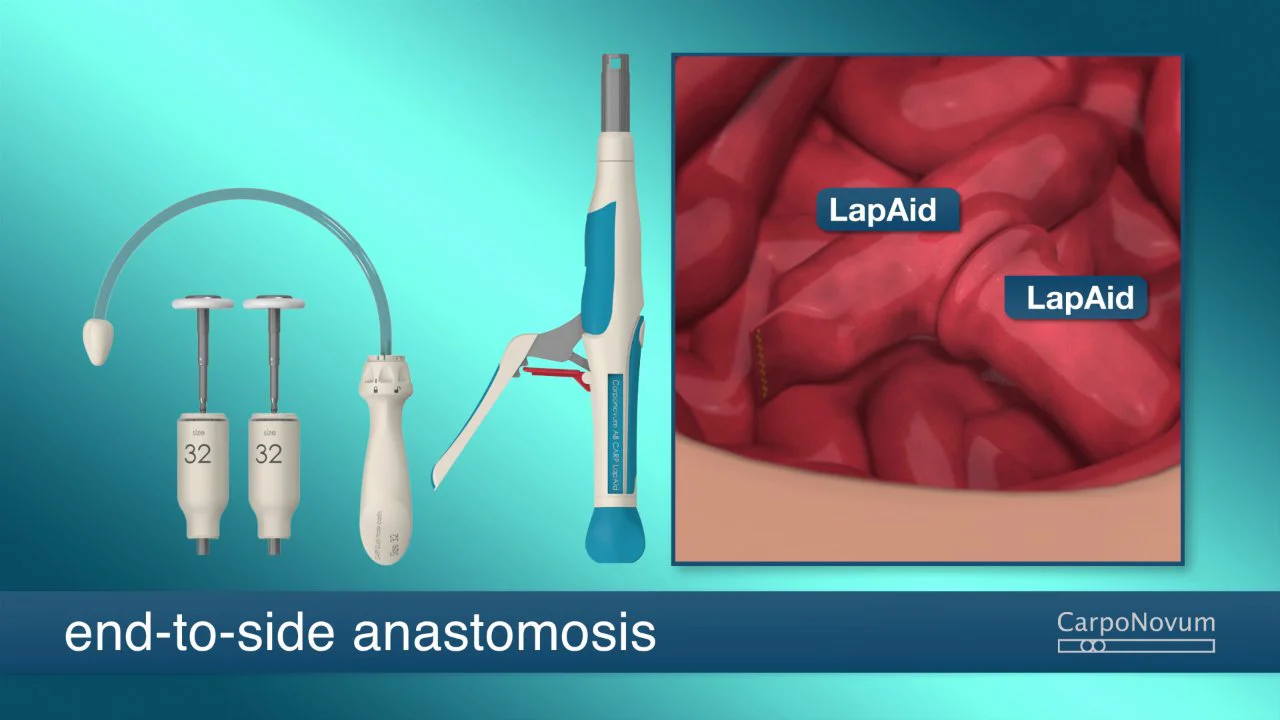 CREX-System on Vimeo