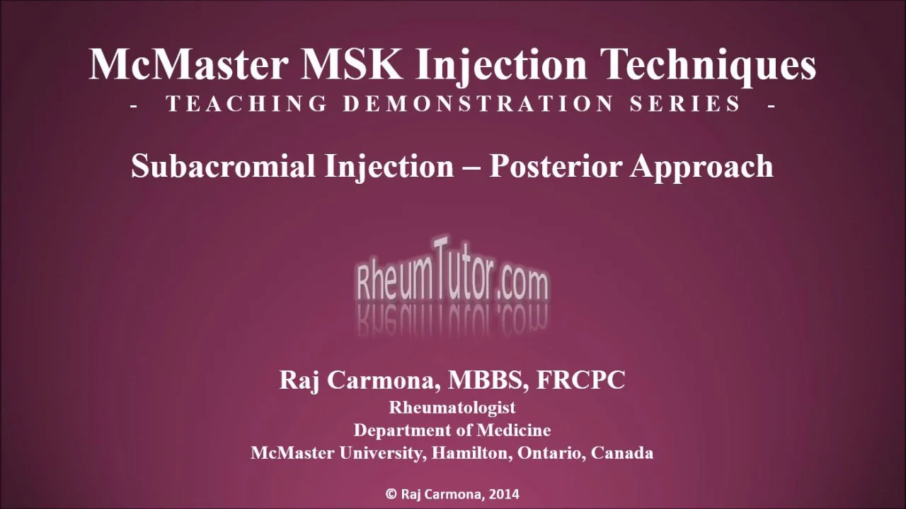 Subacromial Injection - Posterior Approach on Vimeo